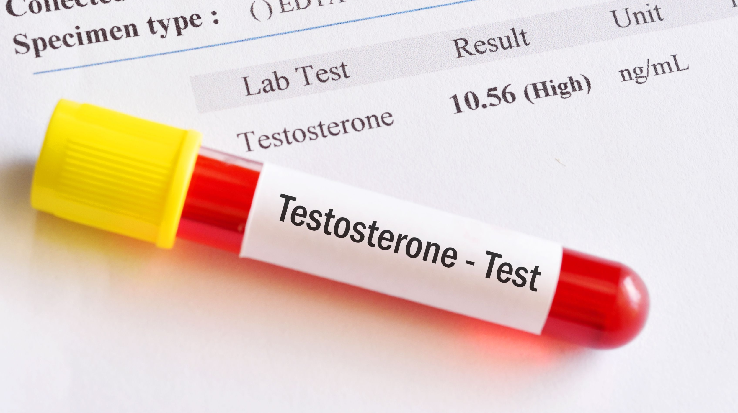 Testosterone Replacement Guide by Mind Pump Media